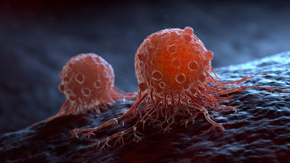 Researchers may have figured out how cancer spreads